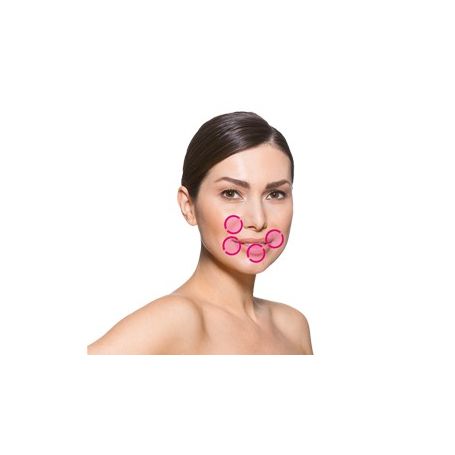 BELOTERO INTENSE LIDO (1x1ml) MERZ AESTHETICS