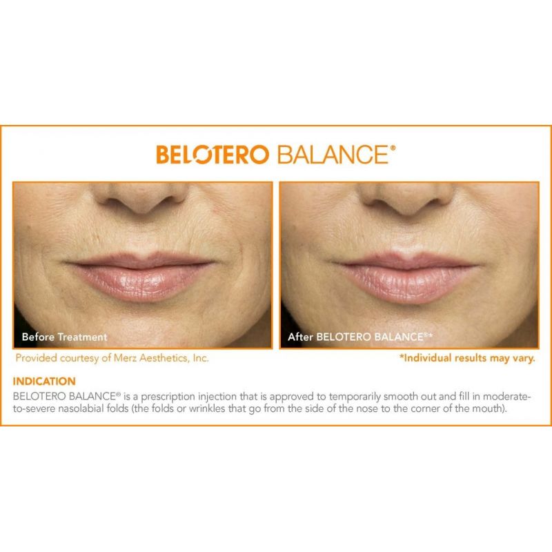 BELOTERO BALANCE (1x1ml) MERZ AESTHETICS
