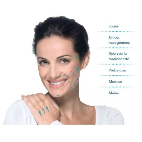 SALE RADIESSE RADIESSE (1x3ml) MERZ IN FRANCE | FRANCE-HEALTH