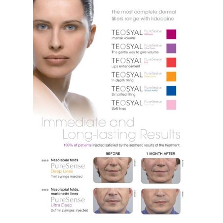 BUY TEOSYAL Puresense ULTIMATE (2x1ml) in FRANCE | Large area volume