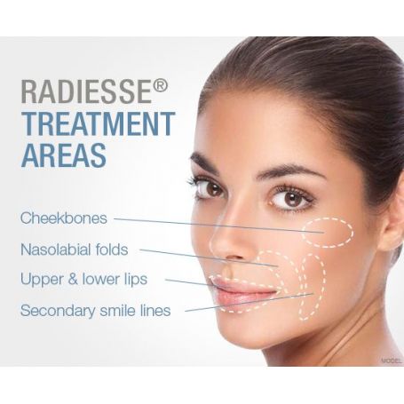 BATCH OF 10 RADIESSE (1x1,5ml) MERZ