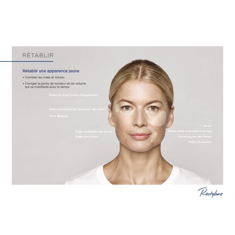 RESTYLANE REFYNE (1x1ml) GALDERMA