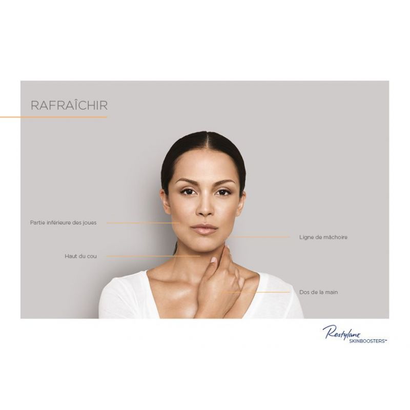 RESTYLANE VITAL LIGHT LIDO SKINBOOSTER (1x1ml) GALDERMA
