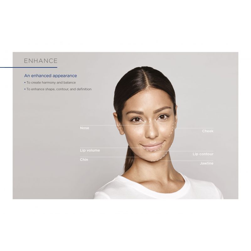 RESTYLANE DEFYNE (1x1ml) GALDERMA