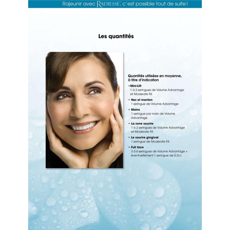 BATCH OF 10 RADIESSE LIDO (1x1,5ml) MERZ