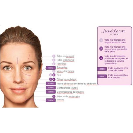 BUY JUVEDERM ULTRA 3| Aesthetic dermal injection: medium wrinkle, lips