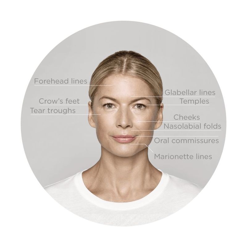 RESTYLANE LIDO (1x1ml) GALDERMA