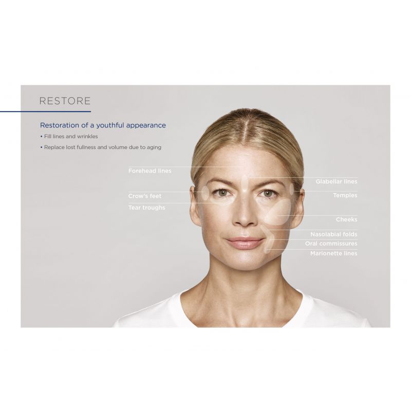 SET VON 10 RESTYLANE LIDO (1x1ml) GALDERMA