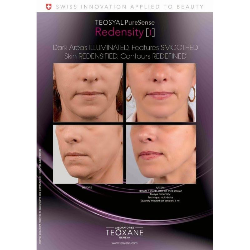 BUY TEOSYAL REDENSITY [I] iTEOXANE n FRANCE | Face, neck and décolleté