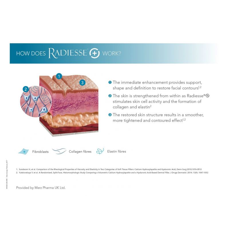 RADIESSE (1x0.8ml) MERZ