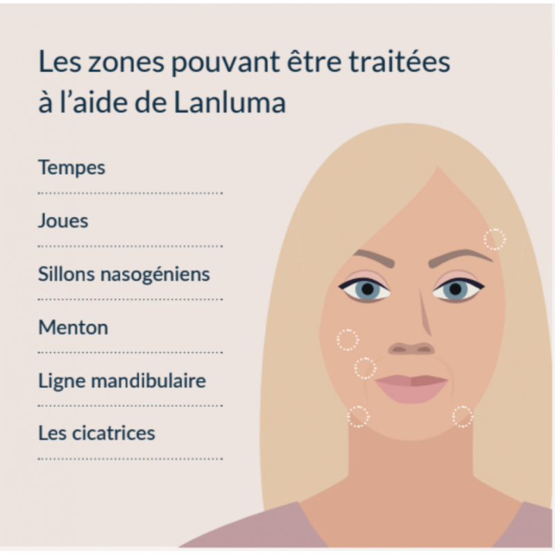 BUY LANLUMA X : Face, neck, décolleté and hands. Natural results
