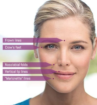 Facial wrinkles | Types, causes and solutions to prevent their appearance